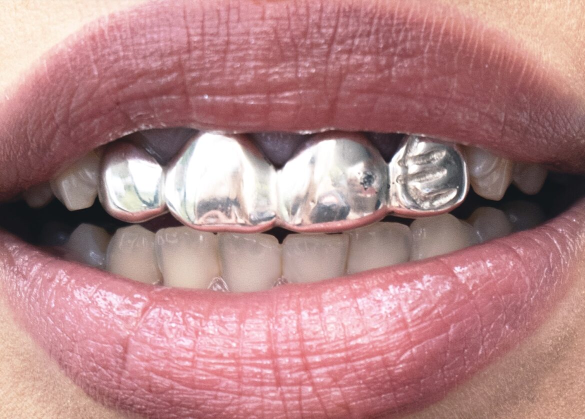 Erik Merisalu – Heavy Metal – OVERSTANDARD – Culture & Creativity